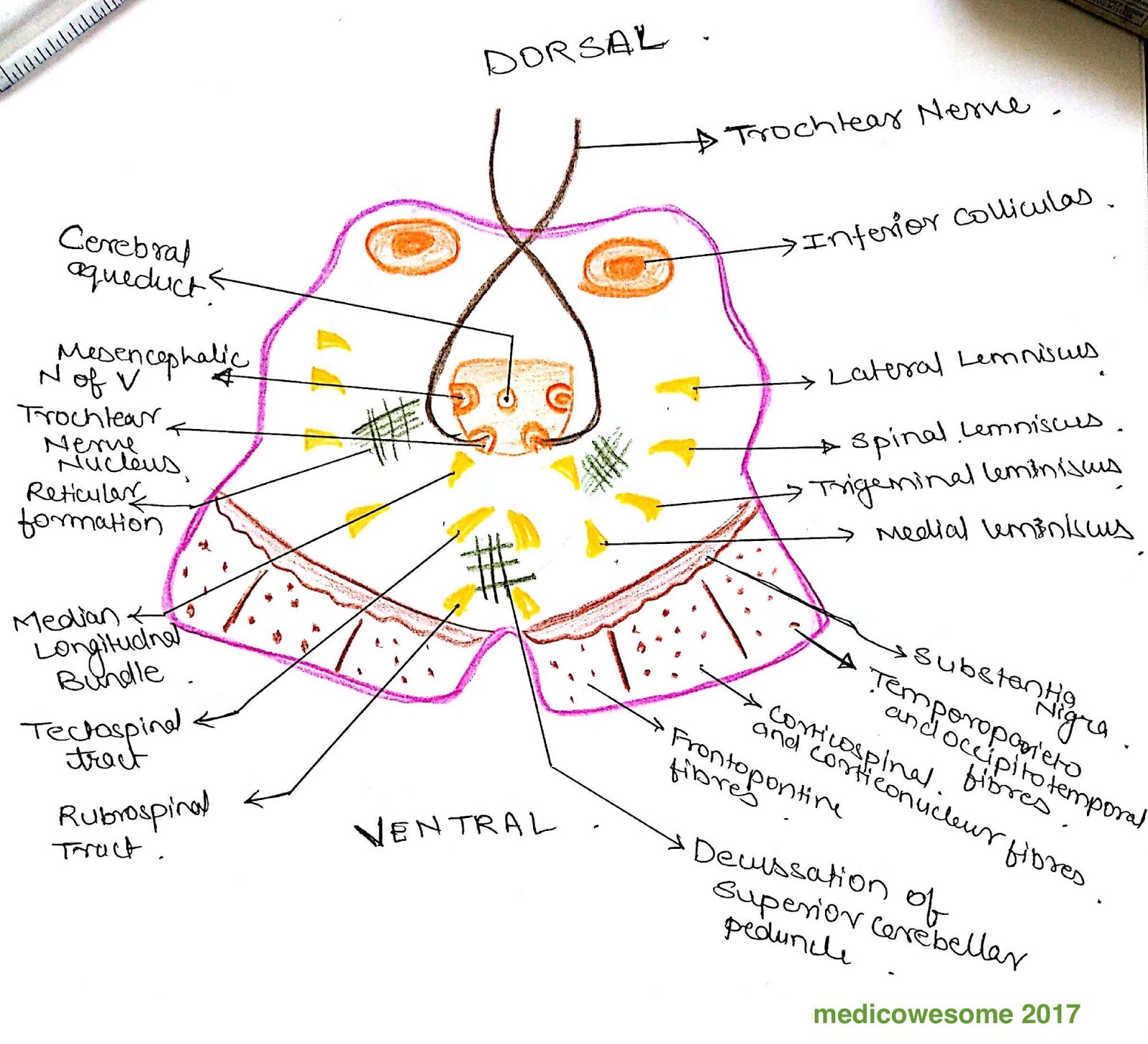 Medicowesome: How to draw midbrain sections and lesions (Fun mnemonic ...