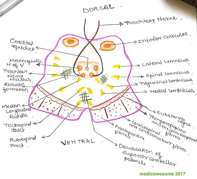 Medicowesome: How to draw midbrain sections and lesions (Fun mnemonic ...