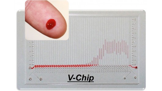 abapsupal: V Chip