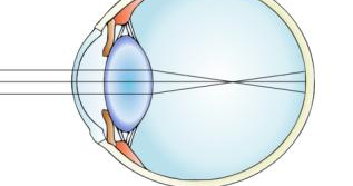 Ciri-Ciri Mata Rabun Dekat dan Rabun Jauh