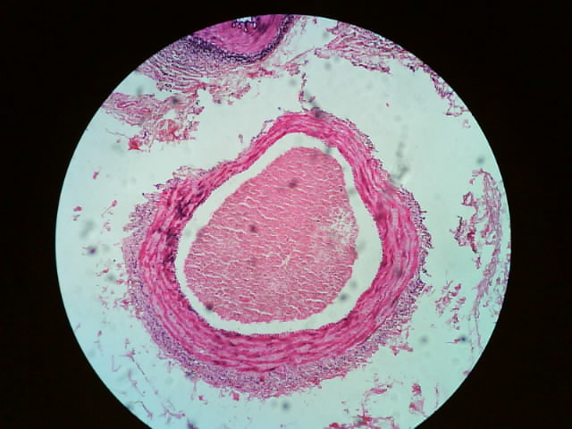 Ca - CaDo (Catatan Calon Dokter): Histologi Sistem Cardiovascular