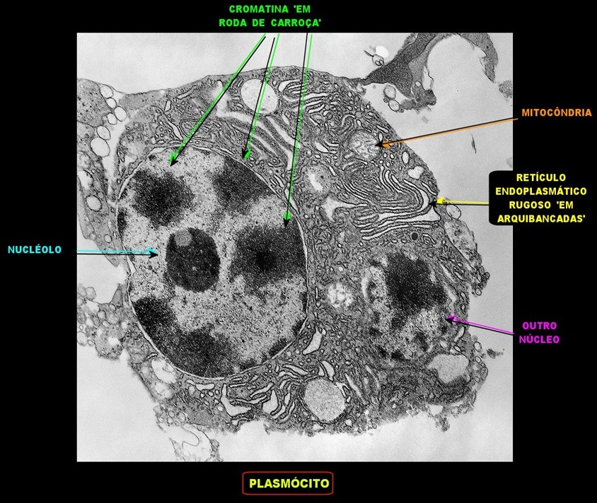 Saúde e a química da célula humana: Plasmócitos e Doenças Associadas