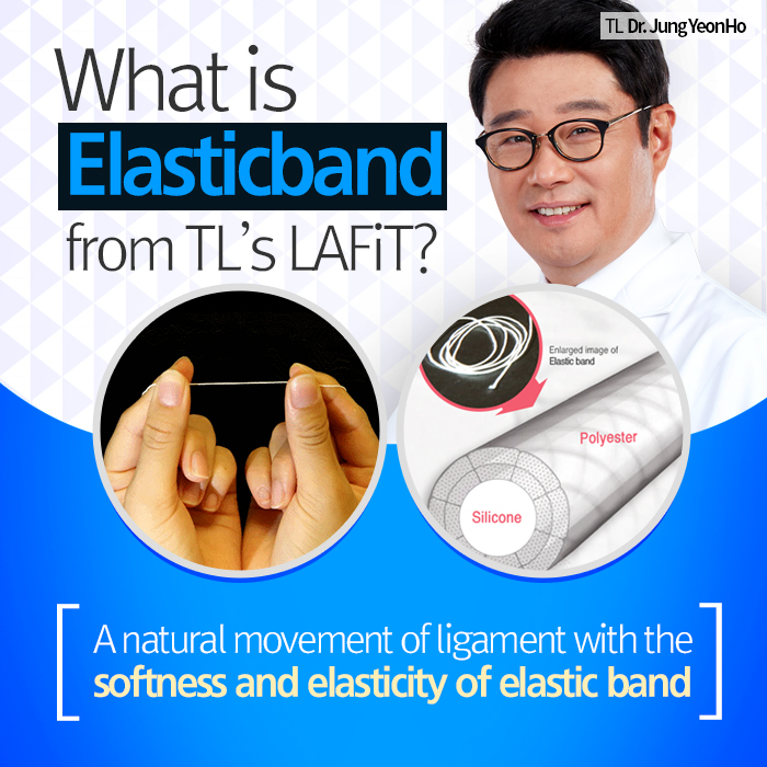 TLlifting_Singapore: elasticum lifting, LAFIT