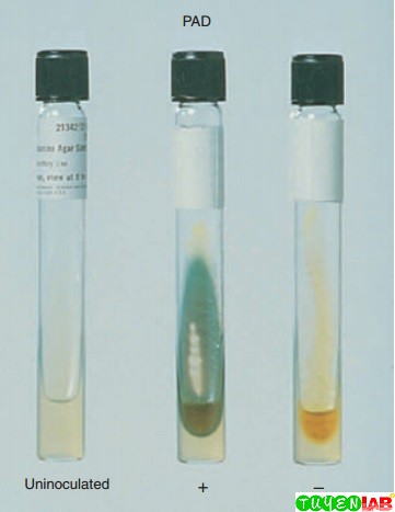 [Microbiology] Biochemical Identification of Gram-Negative Bacteria ...