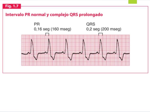 PRUEBA DE TAMIZAJE Y CONFIRMATORIA PARA INSUFICIENCIA CARDÍACA