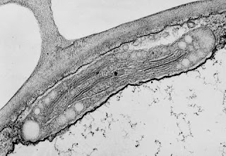 LA CELLULA VEGETALE: I plastidi.