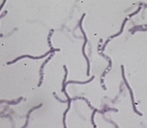 Standard Note: Bacteria