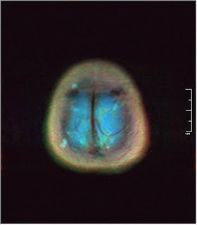 Nevit's blog: False-color Brain MRI (Motion artifacts)