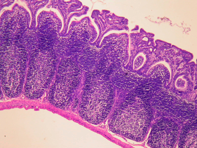 Histologia: Tejido Linfoide