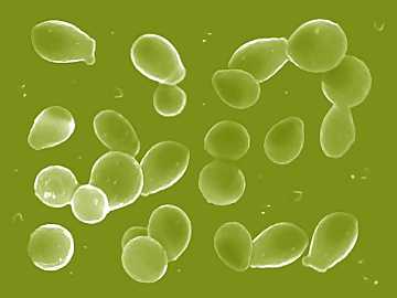 Ascomycetes, Ascomycotina | blog Biologi