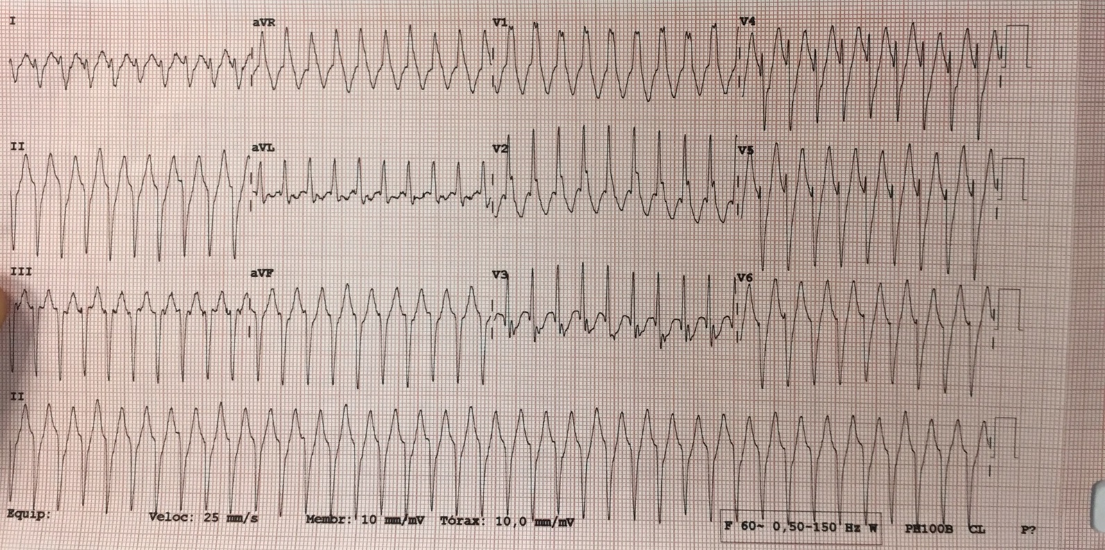 Temas em Cardiologia: Outubro 2015