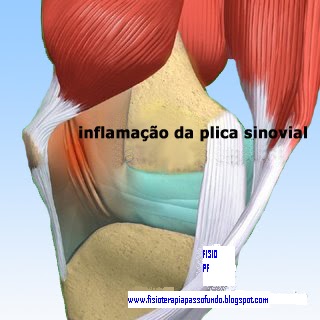 Fisioterapia Passo Fundo: PLICA SINOVIAL