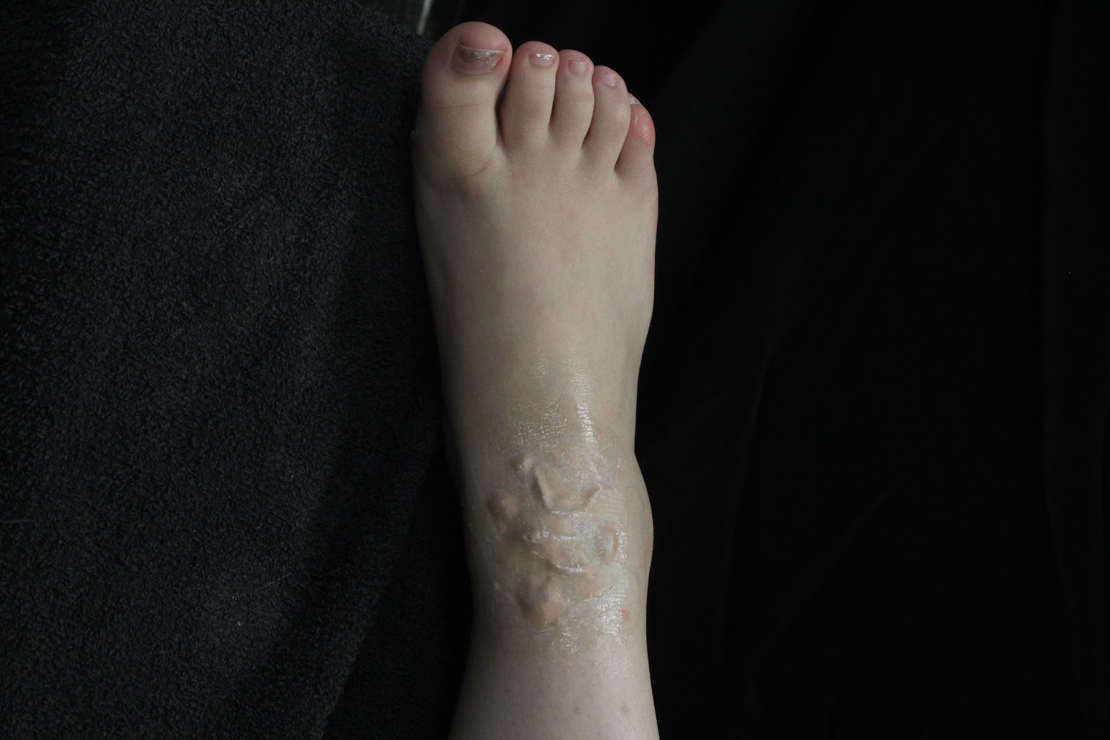 Make-up for Special Effects Unit: Brave New World: Snake Bite Wound ...