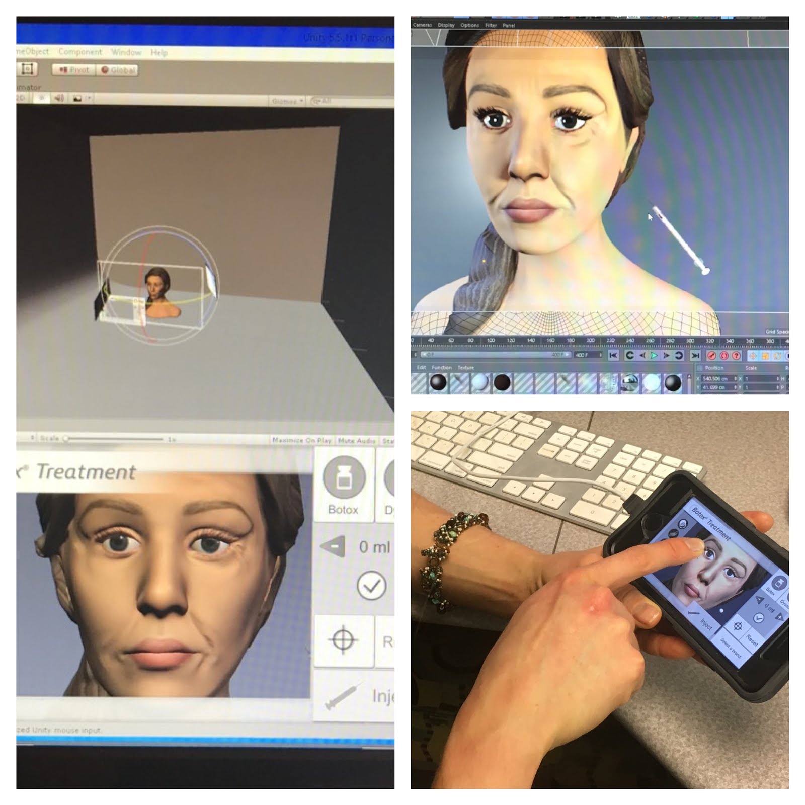 Botox Injection Simulator | Implementing 3D Simulation Modules in the ...