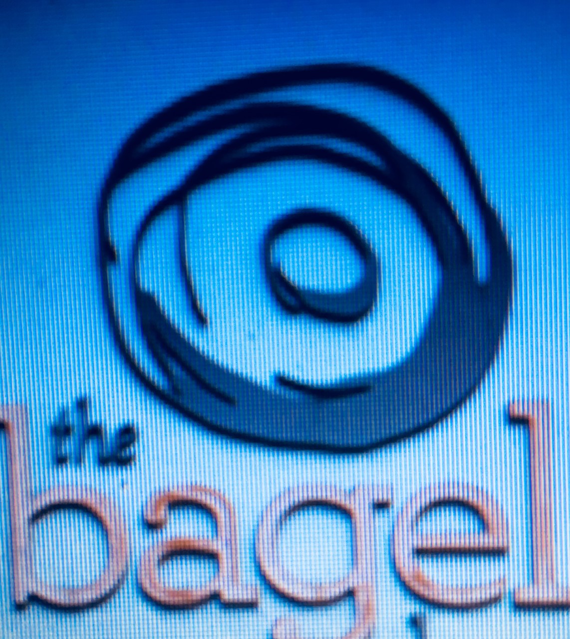 Ob/Gyn Updated : Blob and Bagel sign on Ultrasound can be labelled as ...