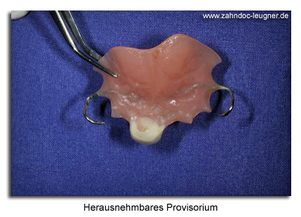 Parodontologie Bochum: Parodontologie Bochum informiert: Verlässliche ...
