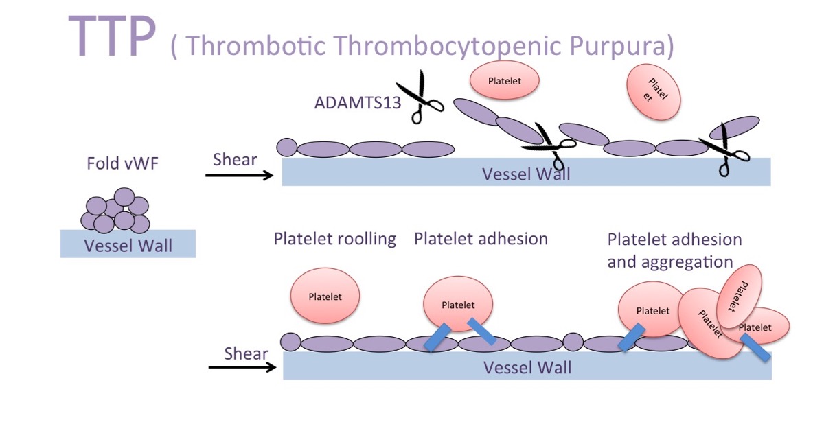 陳鋭溢: 溶血尿毒症候群 （HUS） 栓塞性血小板低下紫斑（TTP） 鑑別診斷