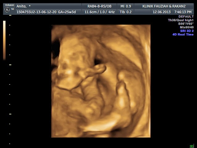 KAK NITA IN THE HOUSE: SCAN BABY 3D/4D - 26 MINGGU