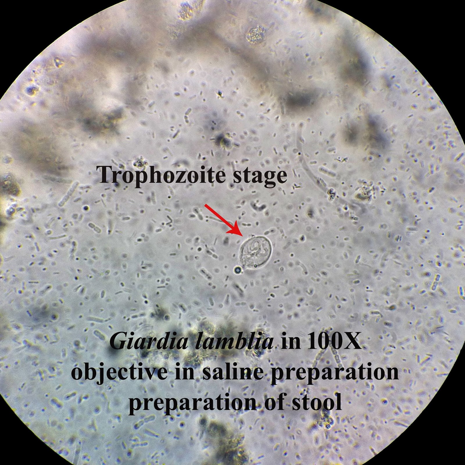 MICROBIOLOGY BLOG FOR STUDENTS (MBLOGSTU): Stages of Giardia lamblia ...