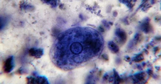 Fun With Microbiology (What's Buggin' You?): Entamoeba polecki