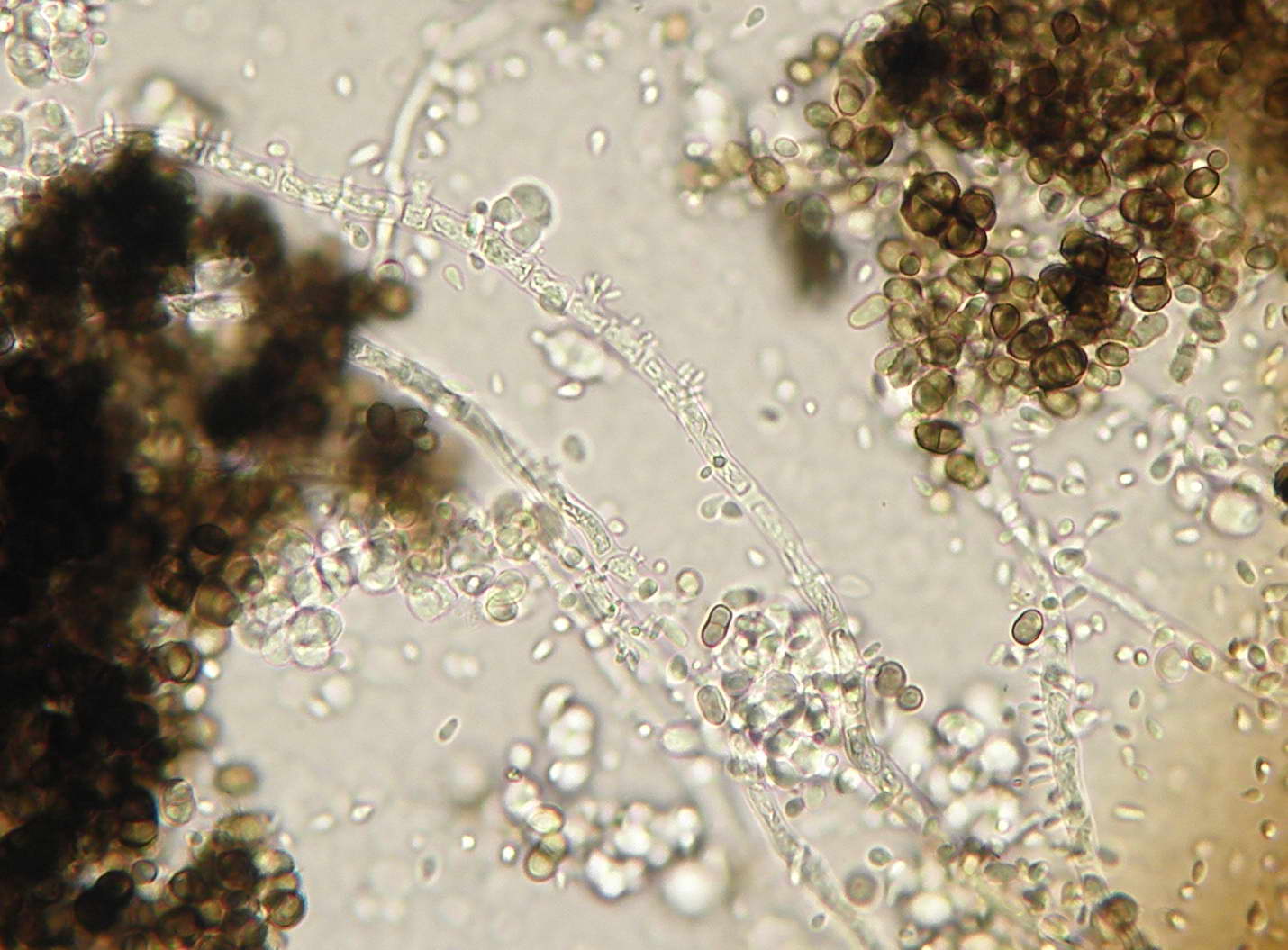 ATLAS MICOLOGIA: AUREOBASIDIUM PULLULANS