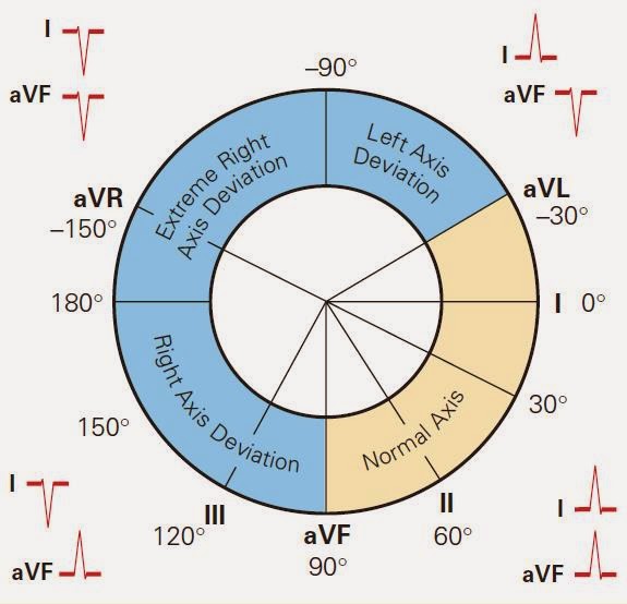 Health: Dasar - dasar EKG (Electrocardiogram)