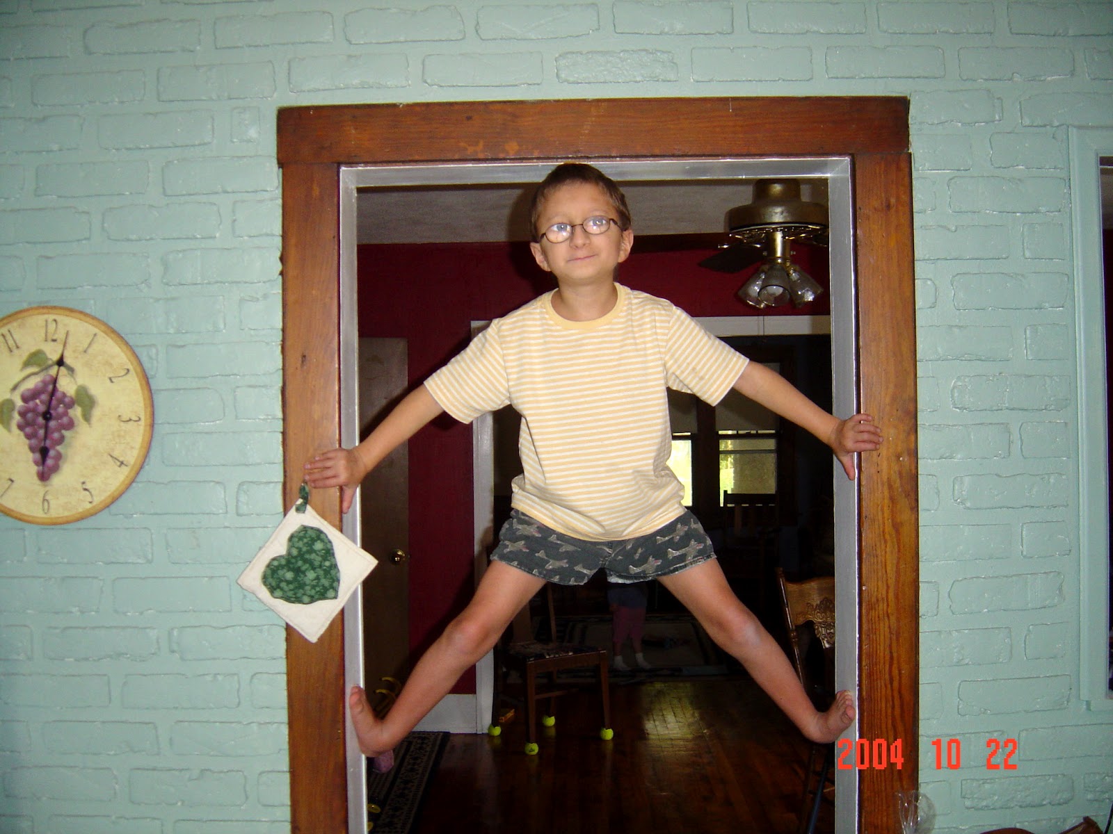 Floating Harbor Syndrome Support Group: Pictures of Jesse at Different Ages