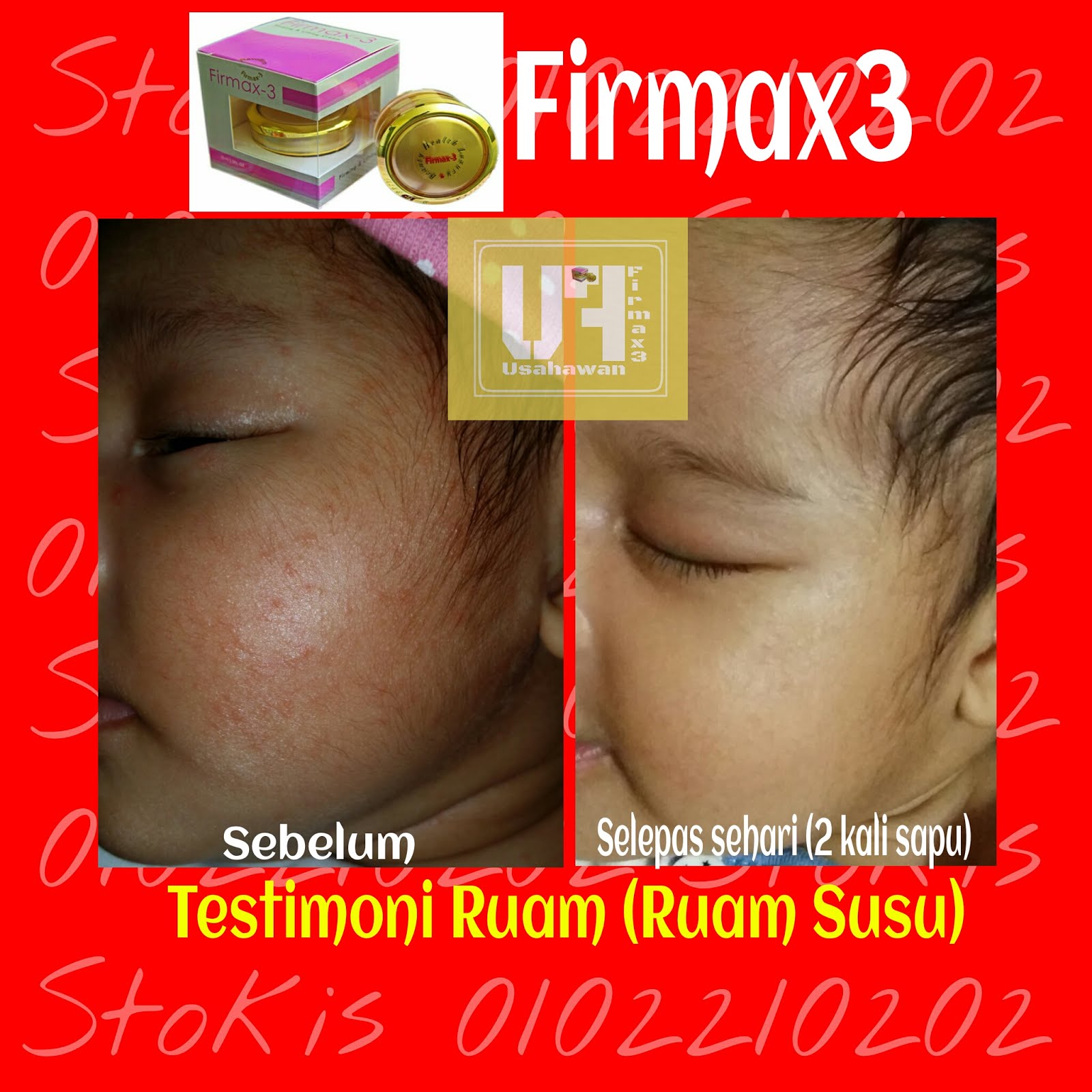 Usahawan Firmax3: Kebaikan dan kelebihan Firmax3 untuk wanita dan lelaki