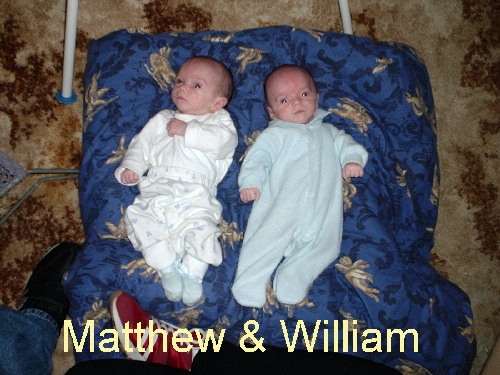 Twin-Twin Transfusion Syndrome (TTTS): Mathew & William by Natasha ...