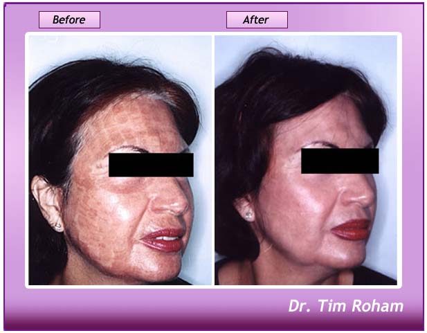 Latest Health & Beauty products today: COSMELAN