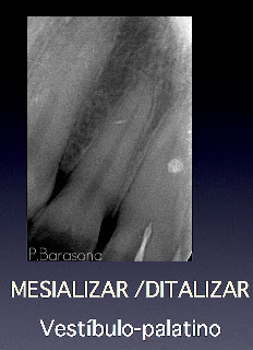 CONDUCTOS CALCIFICADOS