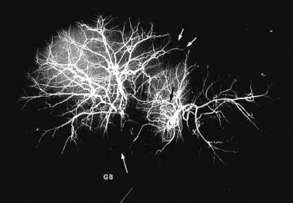 The Pump and the Tubes: Are Hepatic Arteries End Arteries?