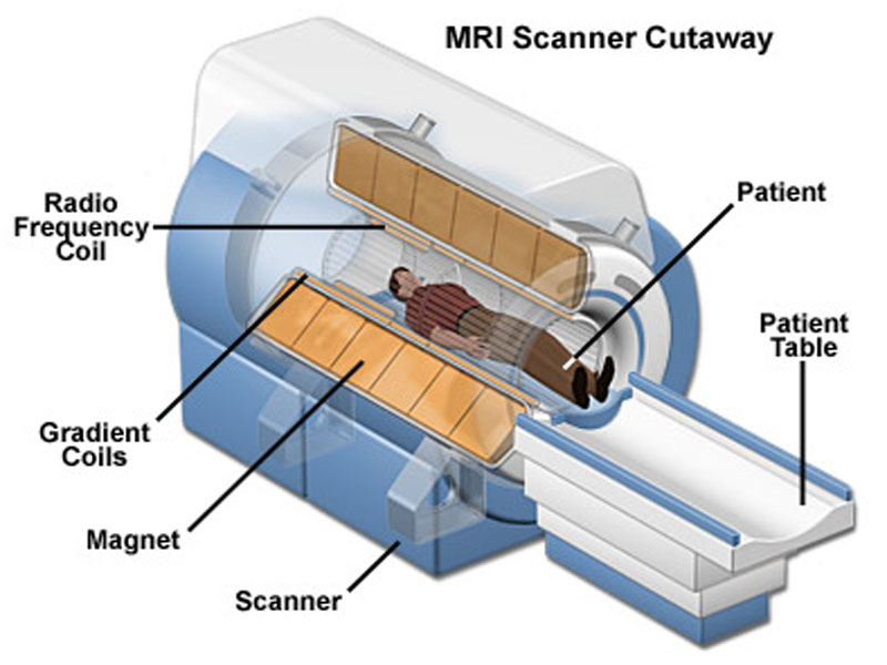 MRI ( Magnetic Resonance Imaging ) ~ World of Radiology