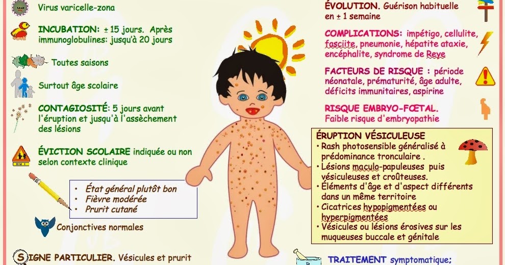 Blog 75: Infos santé-Varicelle