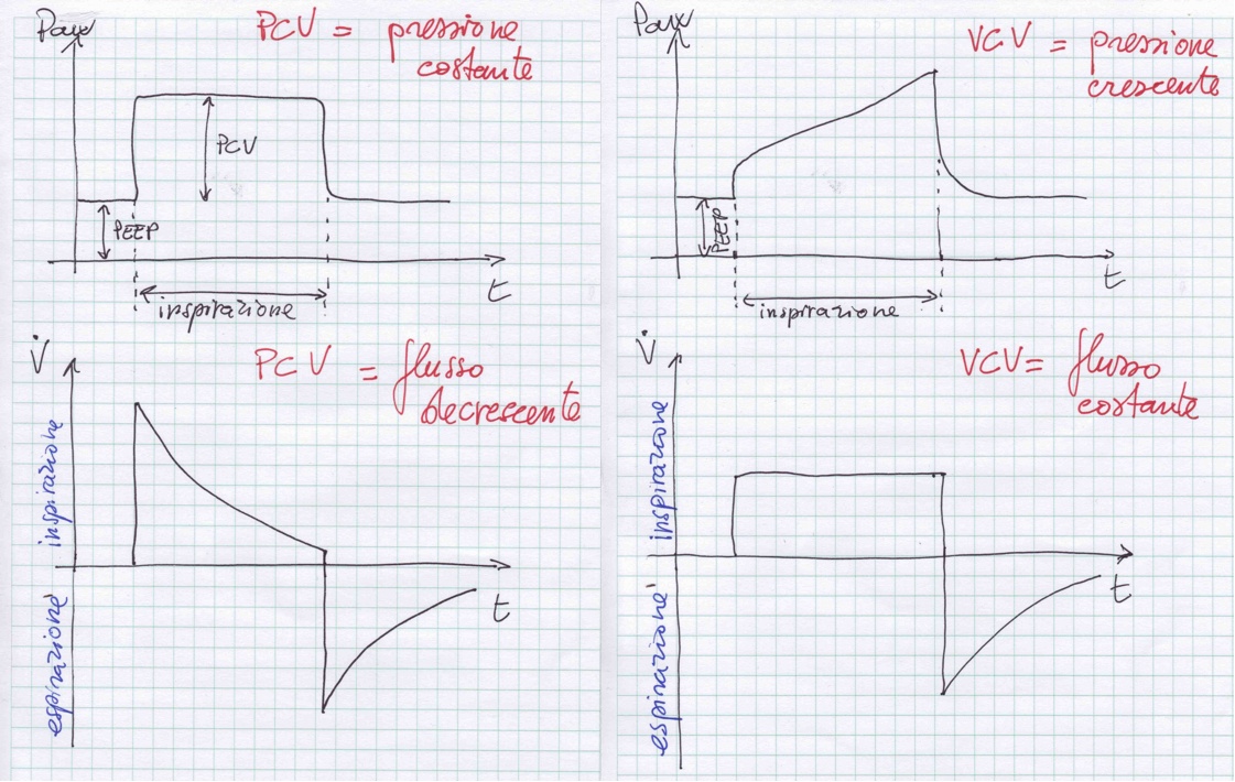 Anestesia & Dintorni: Ventilazione (come scegliere)