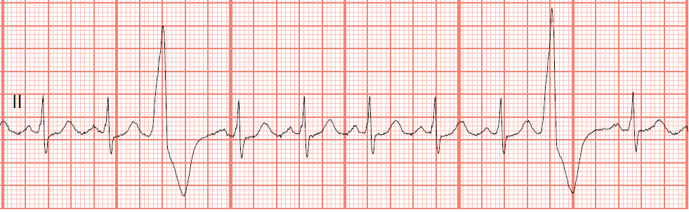 EKG Quiz 327