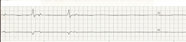 For in that sleep of death what dreams may come...