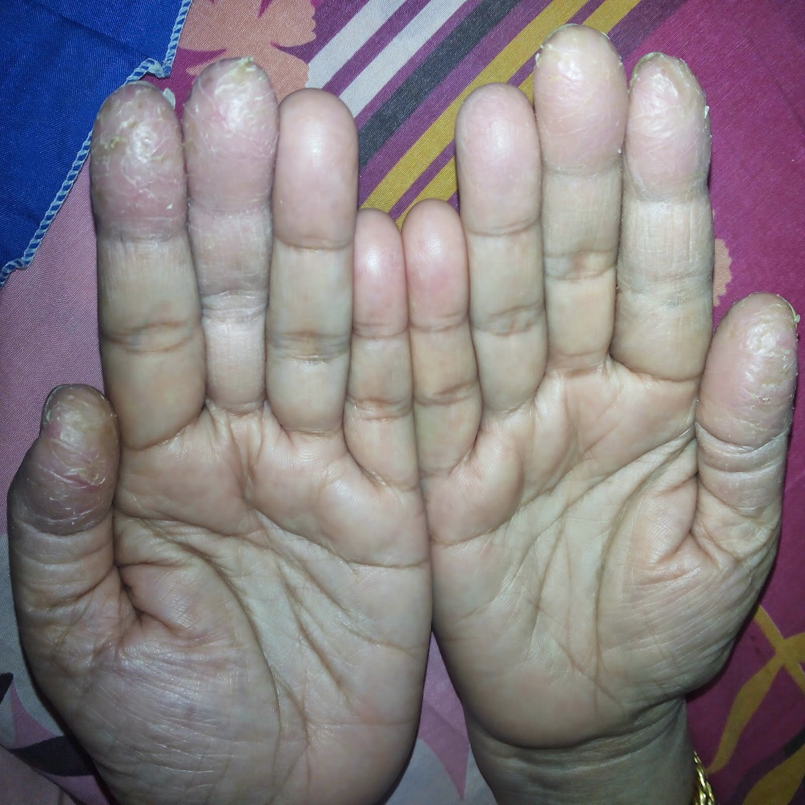 Masalah Cap Jari Rosak