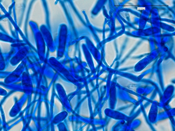 Fun With Microbiology (What's Buggin' You?): Epidermophyton floccosum