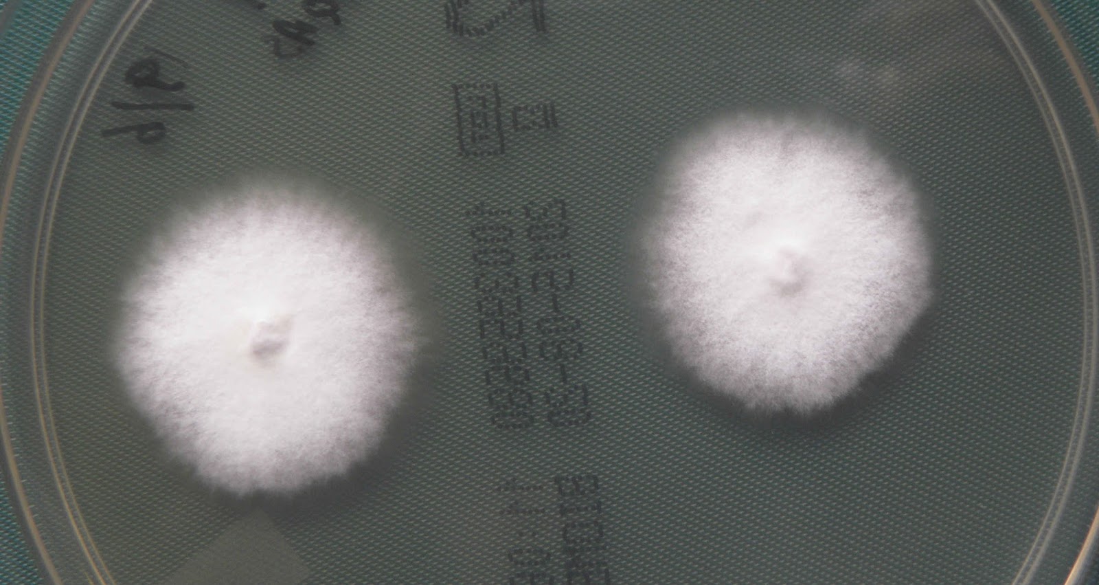 ATLAS MICOLOGIA: TRICHOPHYTON INTERDIGITALE