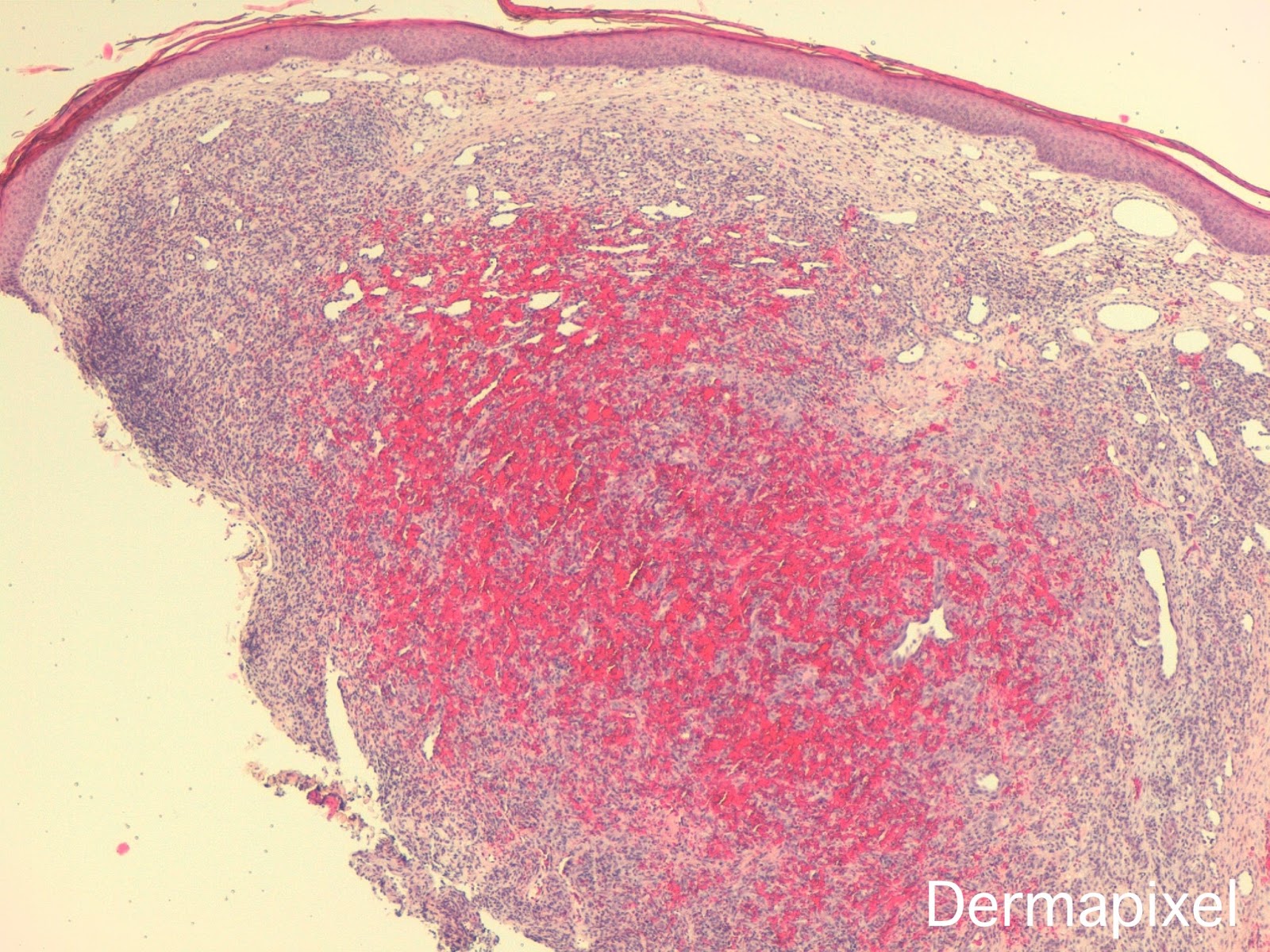 Dermapixel: mayo 2019