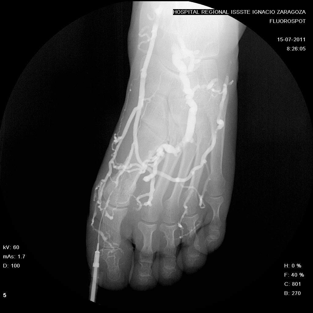 RADIOLOGIA e IMAGEN CETIS 76: FLEBOGRAFIA (extremidades inferiores)