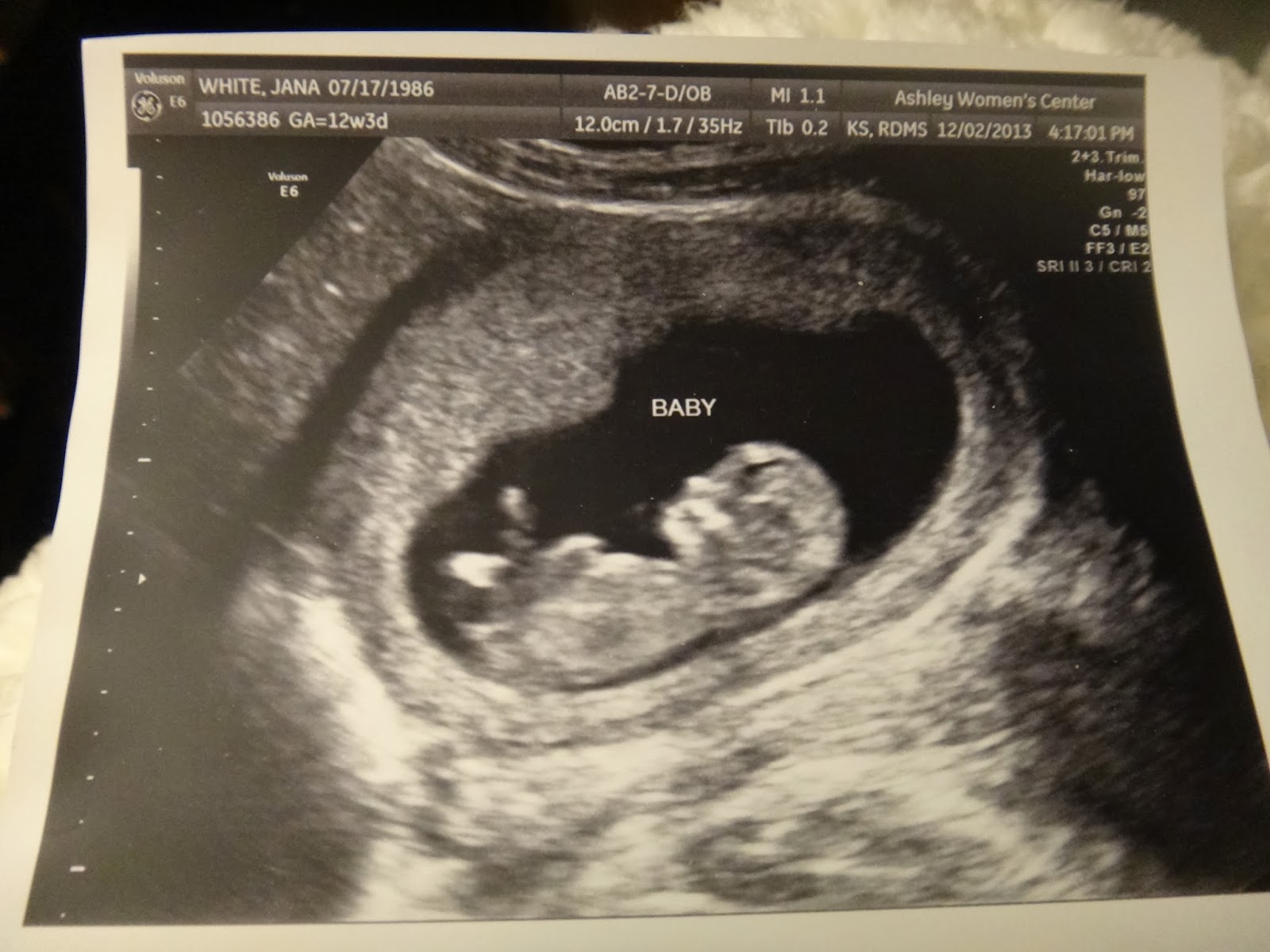 a wife, a mom, and a whole lot of grace: Our First Glimpse of You