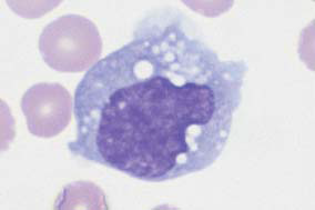 VETERINARY HEMATOLOGY DEXTERVET: phagocytic monocyte with plasma vacuoles