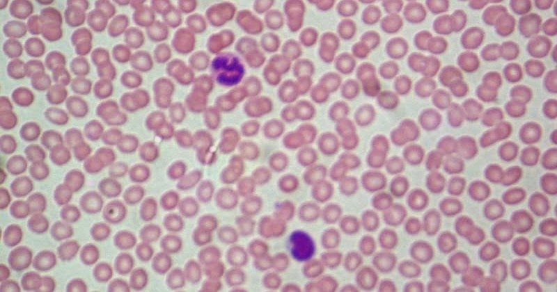 Mr. Forde - Life Science: A typical Blood Slide on High Power