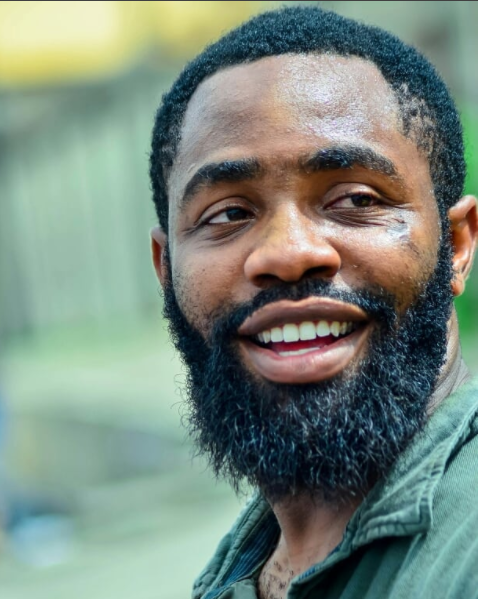 Comedian Arole reveals how he got the scar on his face - GidiHit