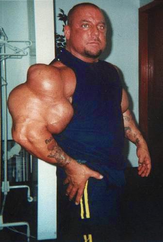 Synthol Freaks of the World | Bodybuilding and Fitness Zone
