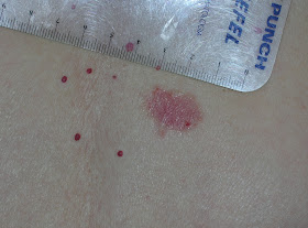 Dermapixel: febrero 2011