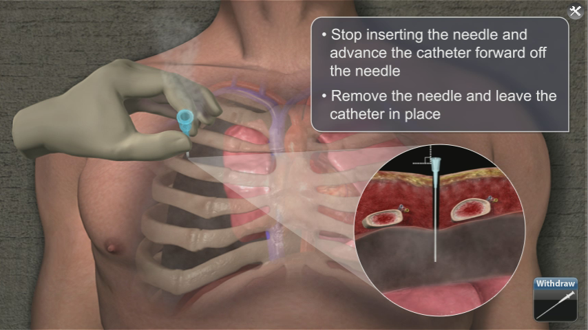 EMS SOLUTIONS INTERNATIONAL by @DrRamonReyesMD marca registrada ...