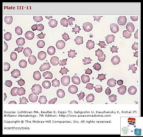 VETERINARY HEMATOLOGY DEXTERVET: acanthocytosis